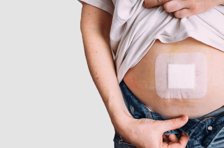 Can Complications Of Hernia Surgery Cause Erectile Dysfunction 4775